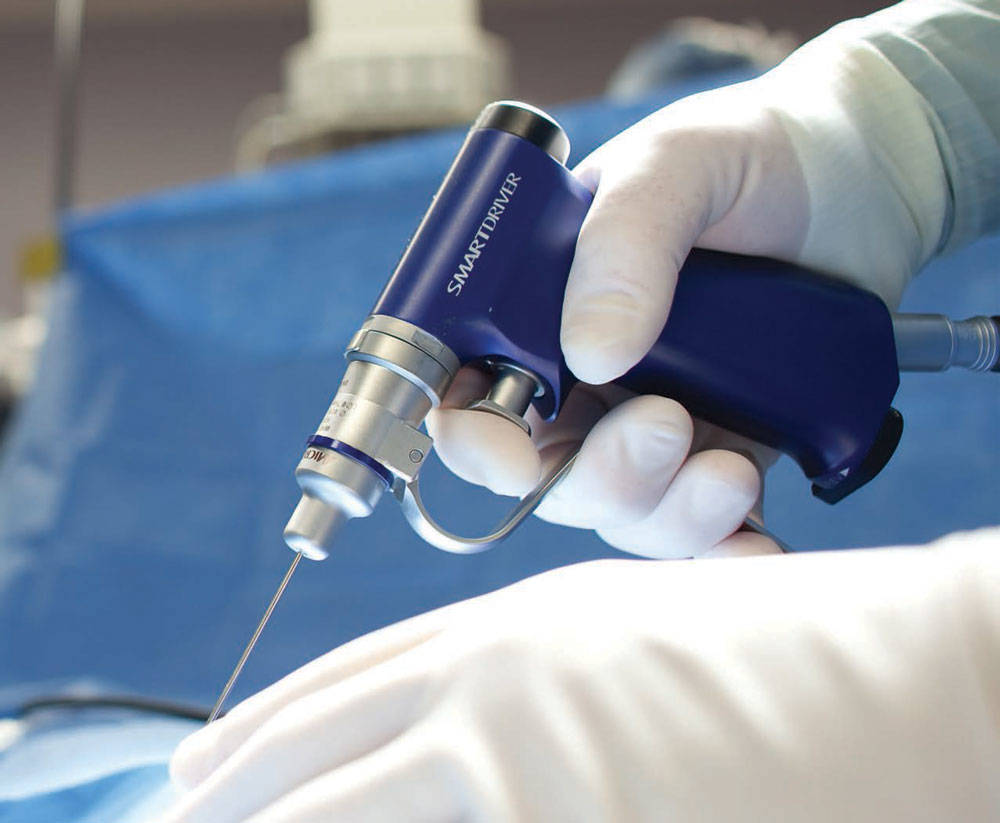 Orthopedics | Securos Surgical