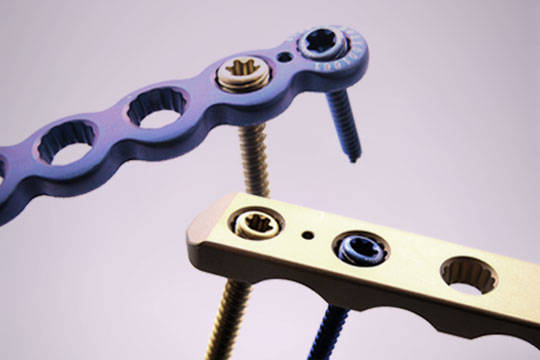 Orthopedics | Securos Surgical